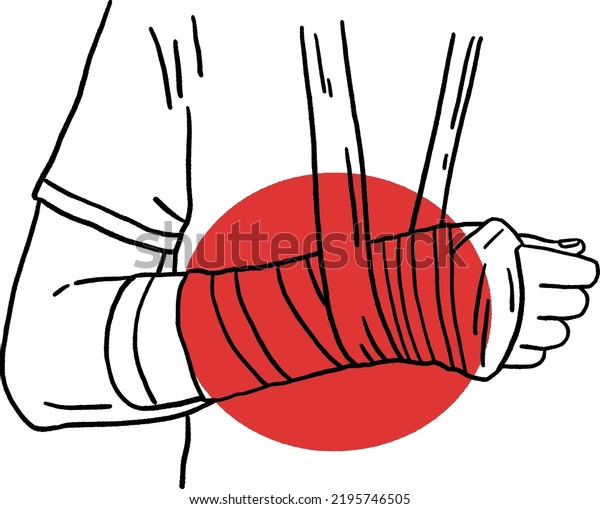 Broken Arm People Hurt Hand Drawn Stock Vector (Royalty Free ...