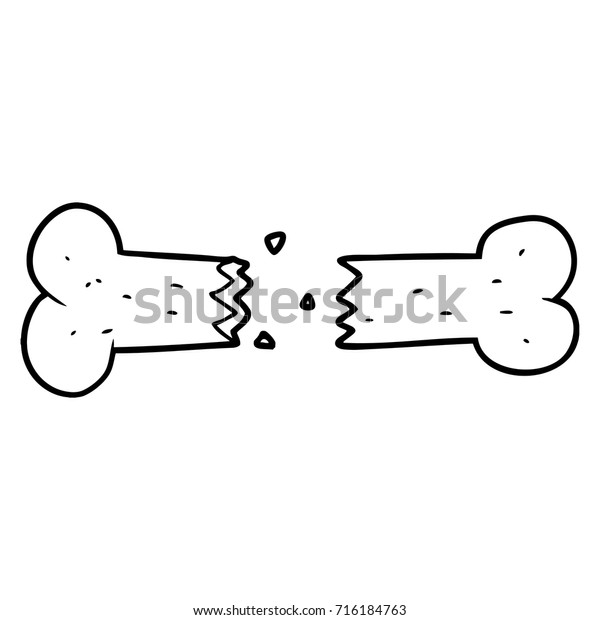 Broken Bone Cartoon: เวกเตอร์สต็อก (ปลอดค่าลิขสิทธิ์) 716184763 ...