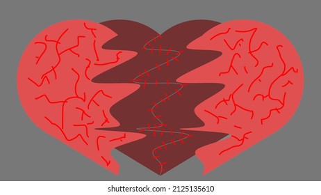 Broken Heart Torn Into Two Parts Stock Vector (Royalty Free) 2125135610 ...