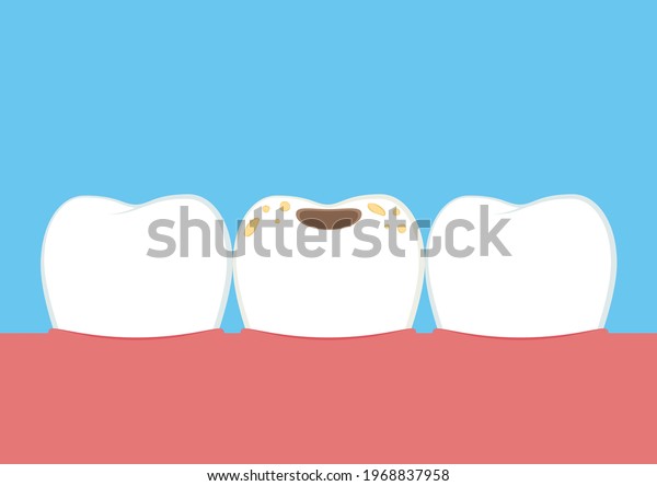 Broken Teeth Cartoon Vector Free Space Stock Vector (Royalty Free ...
