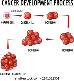 Cancer Development Process Infographic Illustration Stock Vector ...