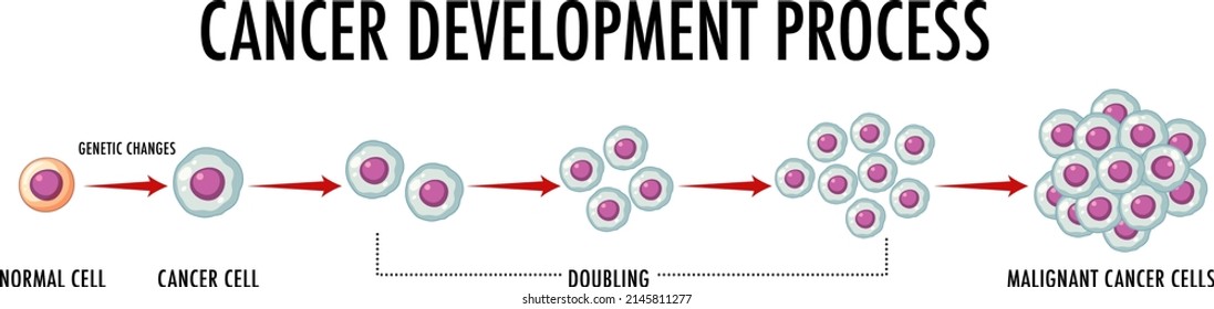 Cancer Development Process Infographic Illustration Stock Vector ...