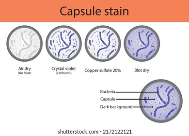 895 Capsule stain Images, Stock Photos & Vectors | Shutterstock