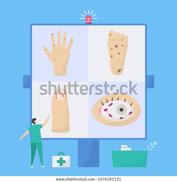 Cardiology Vector Illustration This Disease Endocarditis Stock Vector ...