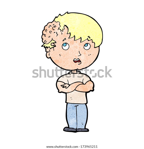 Cartoon Boy Growth On Head Stock Vector (Royalty Free) 173965211 ...