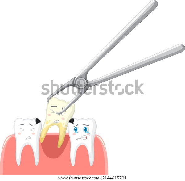 Cartoon Teeth Extraction On White Background: เวกเตอร์สต็อก (ปลอดค่า ...