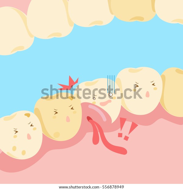 Cartoon Tooth Gingival Swelling Bleeding: vetor stock (livre de ...