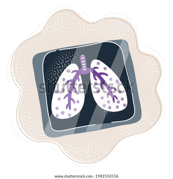 Cartoon Vector Illustration Xray Chest Stock Vector (Royalty Free ...