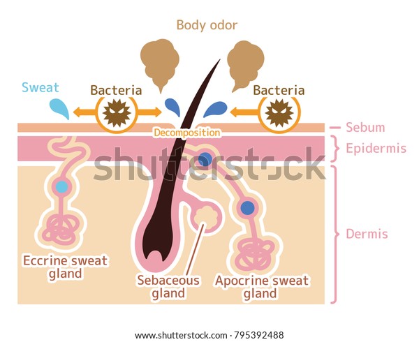 Cause Body Odor Illustration Stock Vector (Royalty Free) 795392488 ...