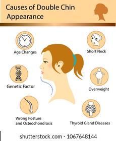 Causes Double Chin Stock Vector (Royalty Free) 1067648144 | Shutterstock