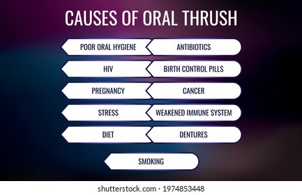Causes Oral Thrush Vector Illustration Medical Stock Vector (Royalty ...