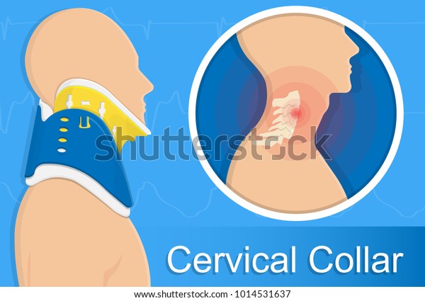 Cervical Collar Prevent Movement Backboard Prehospital Stock Vector ...