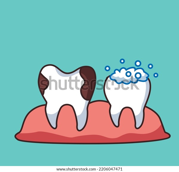 Character Dirty Teeth Clean Teeth Cartoon Stock Vector (Royalty Free ...