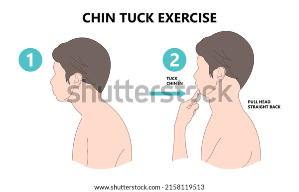 60 Chin Tuck Images, Stock Photos & Vectors | Shutterstock