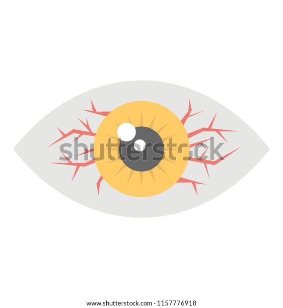 Chronic Conjunctivitis Eye Red Iris Showing Stock Vector (Royalty Free ...