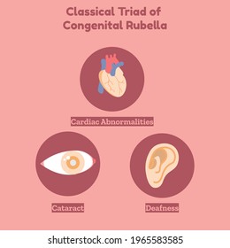 Vektor Stok Classical Triad Congenital Rubella Vector (Tanpa Royalti ...
