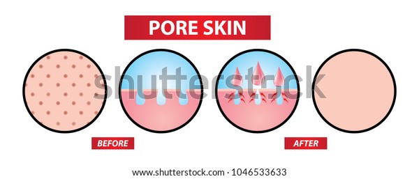 Close Open Pores Skin Before After Stock Vector (Royalty Free ...