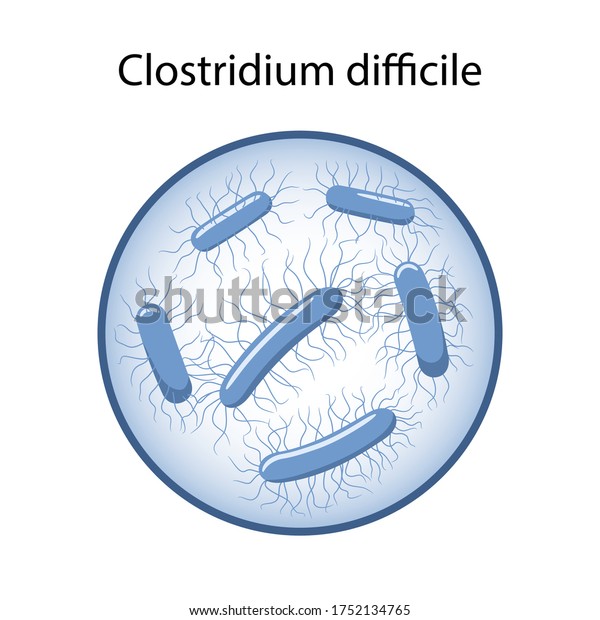 Clostridium difficile in magnifying glass. The causative agent of ...