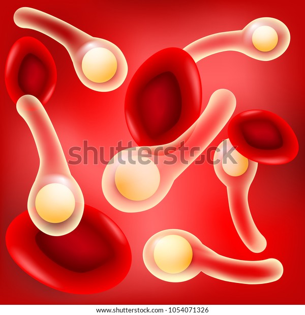 Clostridium tetani. Pathogenic bacterium causing infection Tetanus ...
