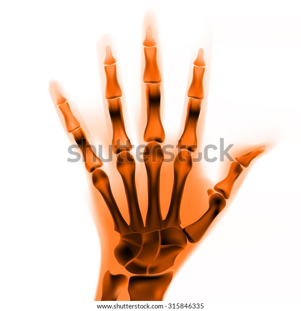 Colorful Vector Xray Hand Stock Vector (Royalty Free) 315846335 ...