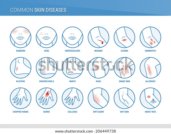Common skin diseases