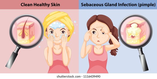 Comparison Skin Condition Illustration Stock Vector (Royalty Free ...