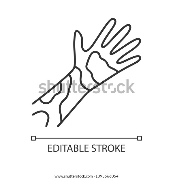 Contact Dermatitis Hives Linear Icon Thin Stock Vector Royalty Free