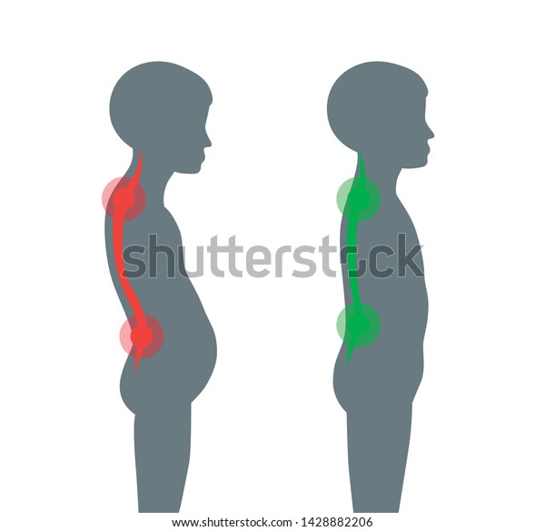 Correct Alignment Kid Body Standing Posture 库存矢量图（免版税）1428882206 ...