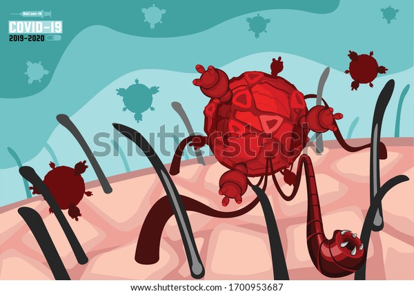 Covid19 Virus Attacks Skin About Attack Stock Vector (Royalty Free ...