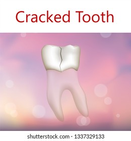 Cracked Tooth Vector Realistic Anatomy Illustration Stock Vector ...
