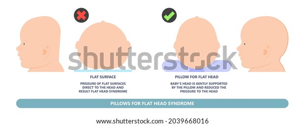 1,273 Flathead Stock Vectors, Images & Vector Art | Shutterstock