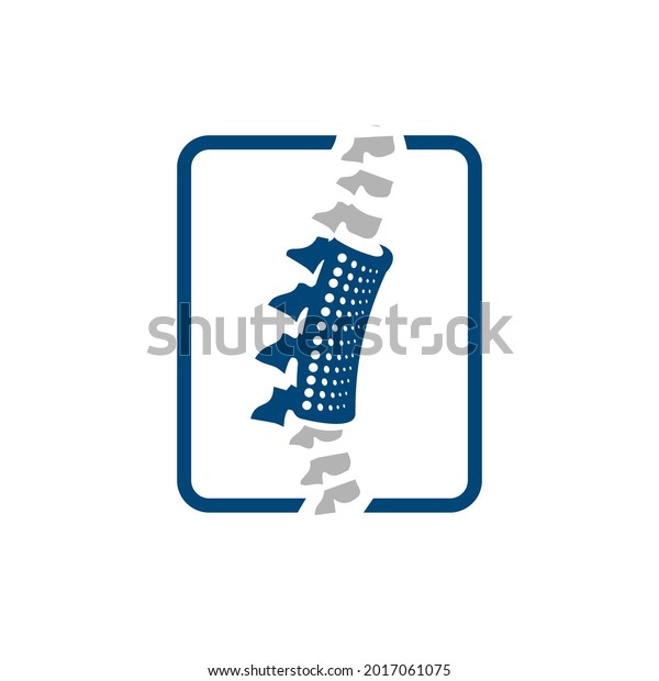 Creative Brand Sign Orthopedic Bone Implants Stock Vector (Royalty Free ...