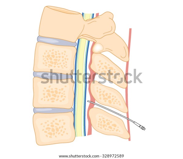 Cross Section Spine Showing Spinal Cord Stock Vector (Royalty Free ...