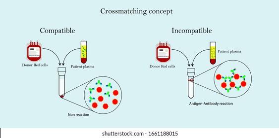 Crossmatching Between Donor Red Cell Patient Stock Vector (Royalty Free ...