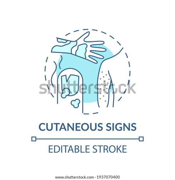 Cutaneous Signs Concept Icon Global Pandemic Stock Vector (Royalty Free ...