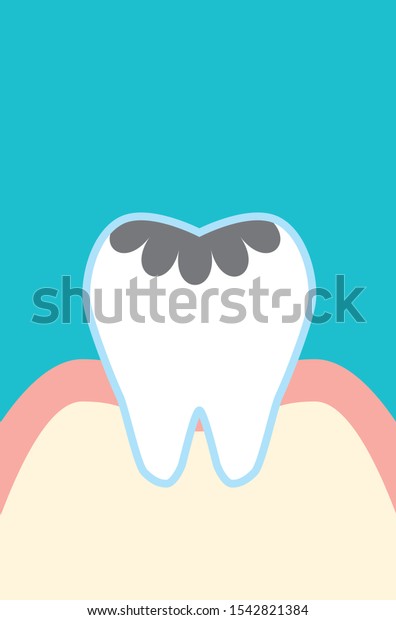 Cute Cartoon Decayed Tooth Illustration Stock Vector (Royalty Free ...