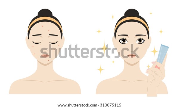 Cute Cartoon Girl Skin Problem Shows Stock Vector (Royalty Free ...