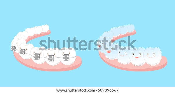 Cute Cartoon Tooth Wear Different Brace Stock Vector (Royalty Free ...