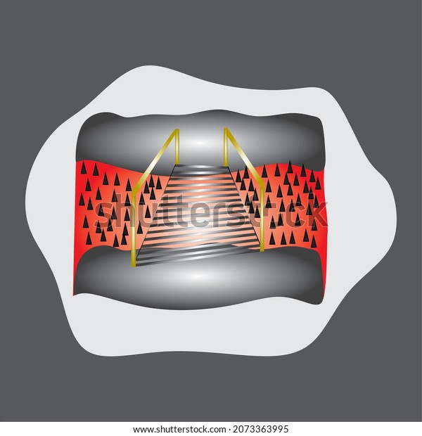 Dangerous Hell Bridge Drawing Illustration Stock Vector (Royalty Free ...