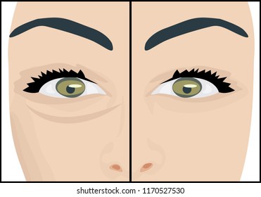 72 Dull Face Before After Images, Stock Photos & Vectors | Shutterstock
