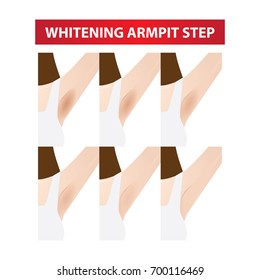 Dark White Armpit Step Vector Illustration Stock Vector (Royalty Free ...