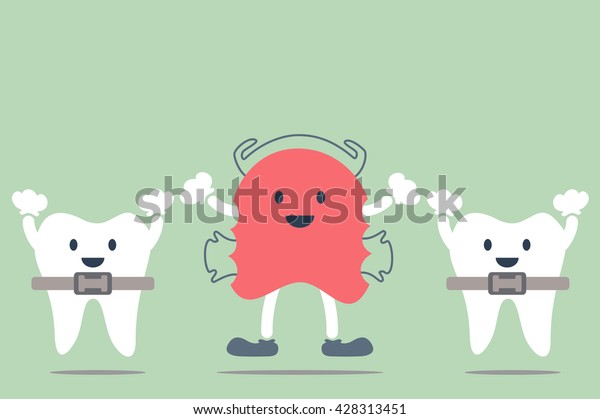 Dental Cartoon Vector Orthodontic Teeth Retainer: เวกเตอร์สต็อก (ปลอด ...