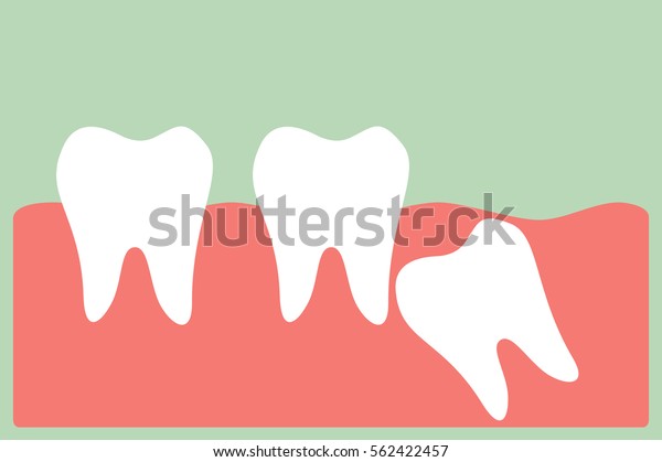 Dental Cartoon Vector Wisdom Tooth Stock Vector (Royalty Free ...