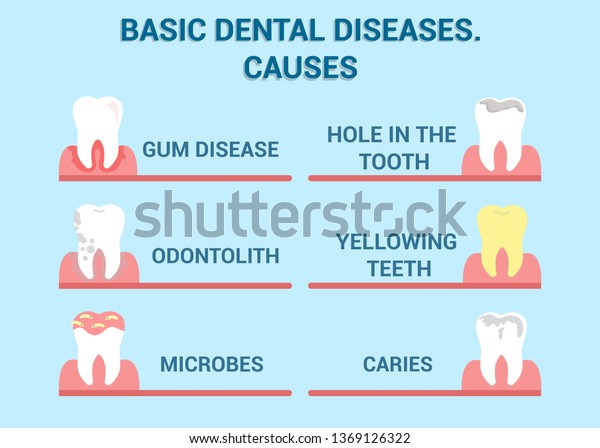 Dental Diseases Cavity Illness Vector Info Stock Vector (Royalty Free ...