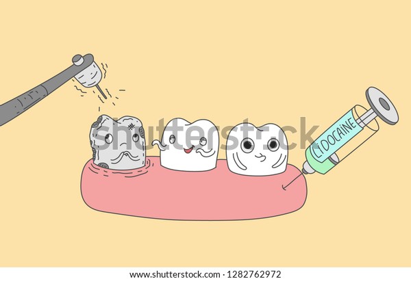 Dental Injection Tooth Extraction Syringe Anesthetizing Stock Vector ...