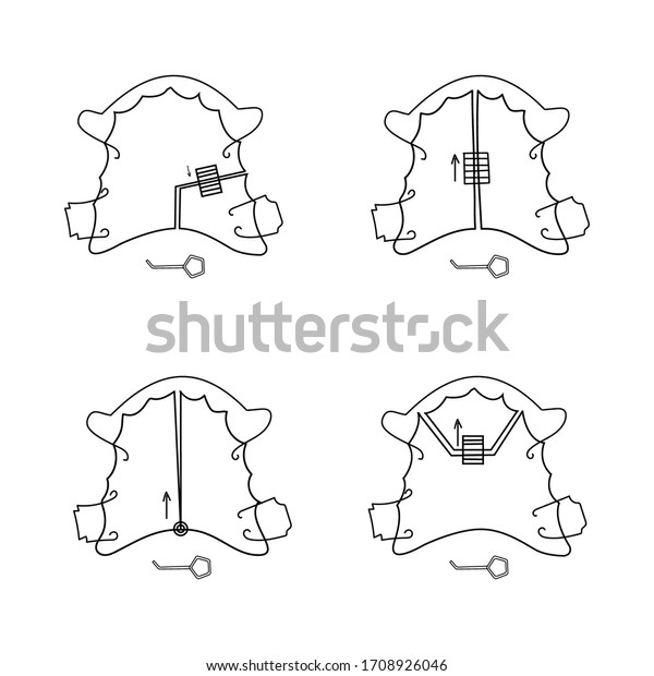 Dentistry Orthodontic Apparatus Correcting Position Teeth Stock Vector ...