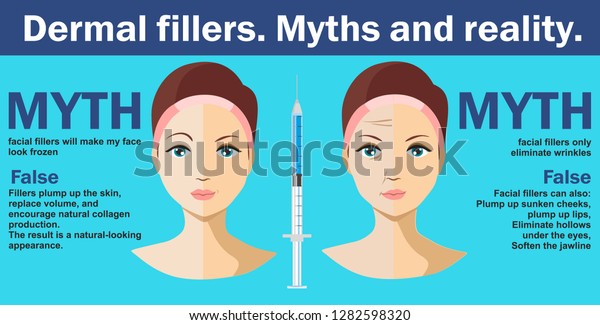 Dermal Filler Injections Infographics Vector Illustration Stock Vector ...