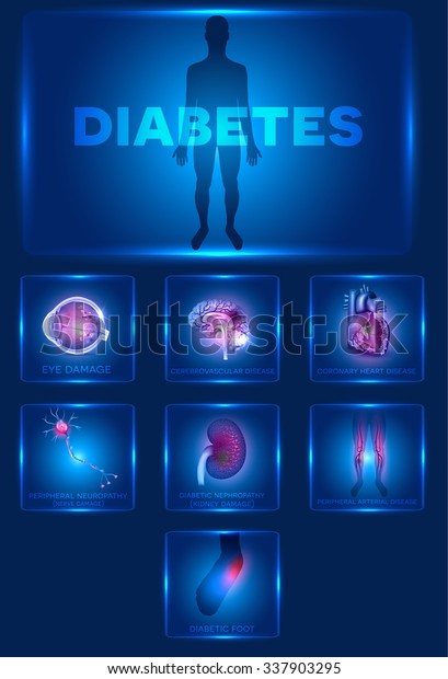 Diabetes Affected Organs Blue Design Info Stock Vector (Royalty Free ...
