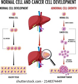 Diagram Showing Cancer Development Process Illustration Stock Vector ...