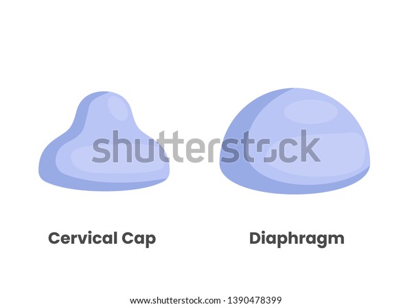 Diaphragm Cervical Cap Illustration Stock Vector (Royalty Free) 1390478399